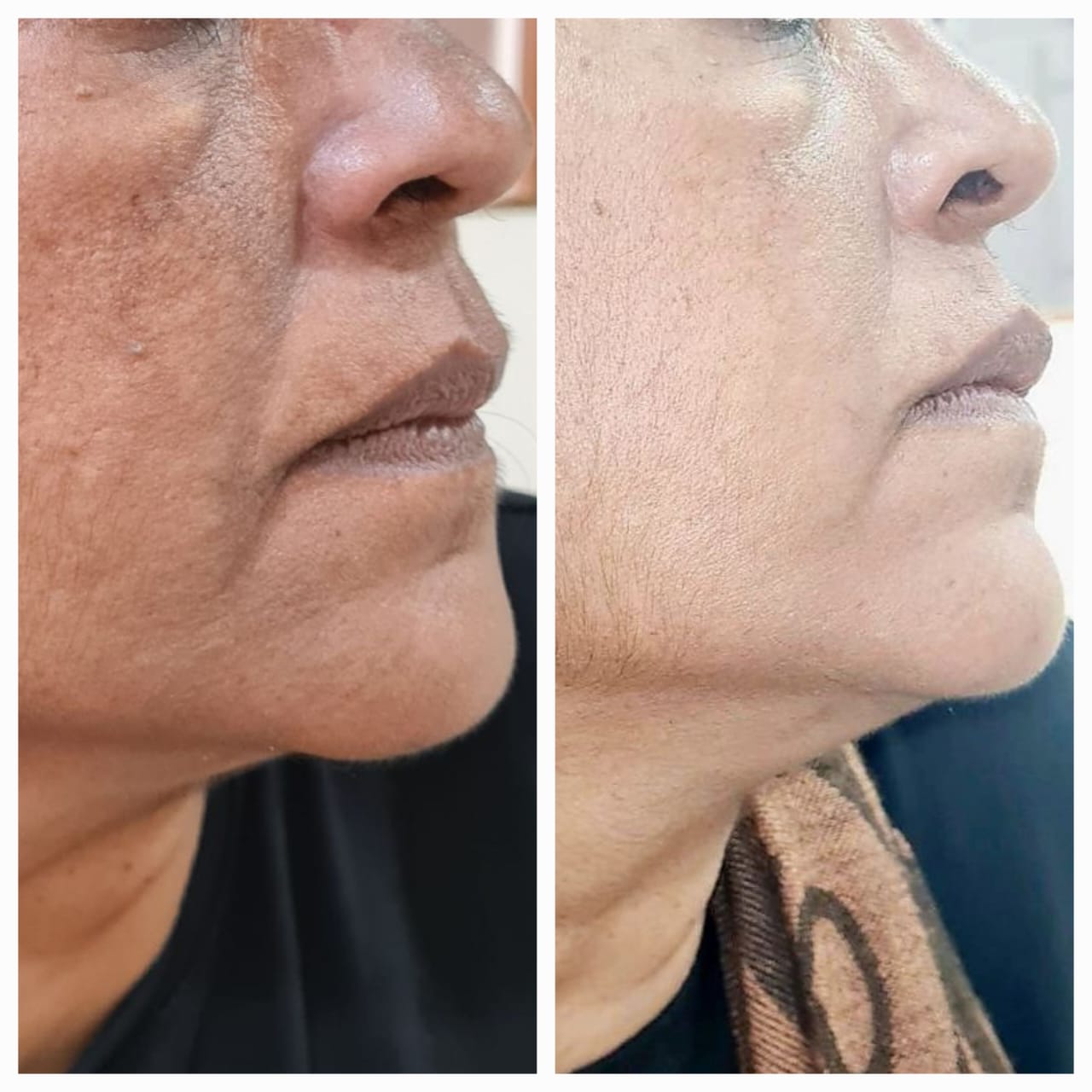 dermatologist doctors In Phursungi, Hadapsar, Manjari | hair loss ...