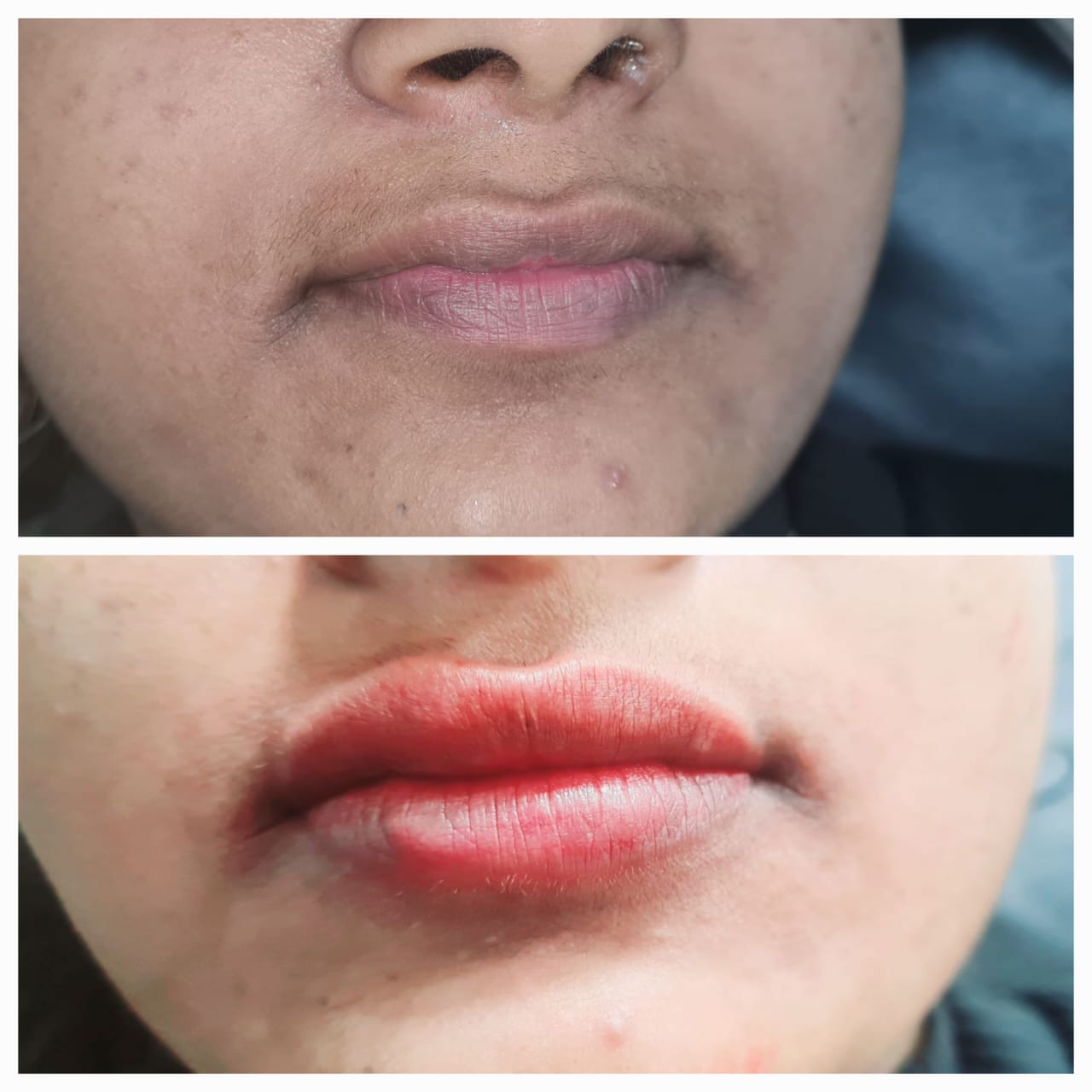 dermatologist doctors In Phursungi, Hadapsar, Manjari | hair loss ...